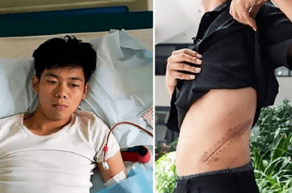 Dix ans après avoir vendu son rein contre un iPhone, il se retrouve ...