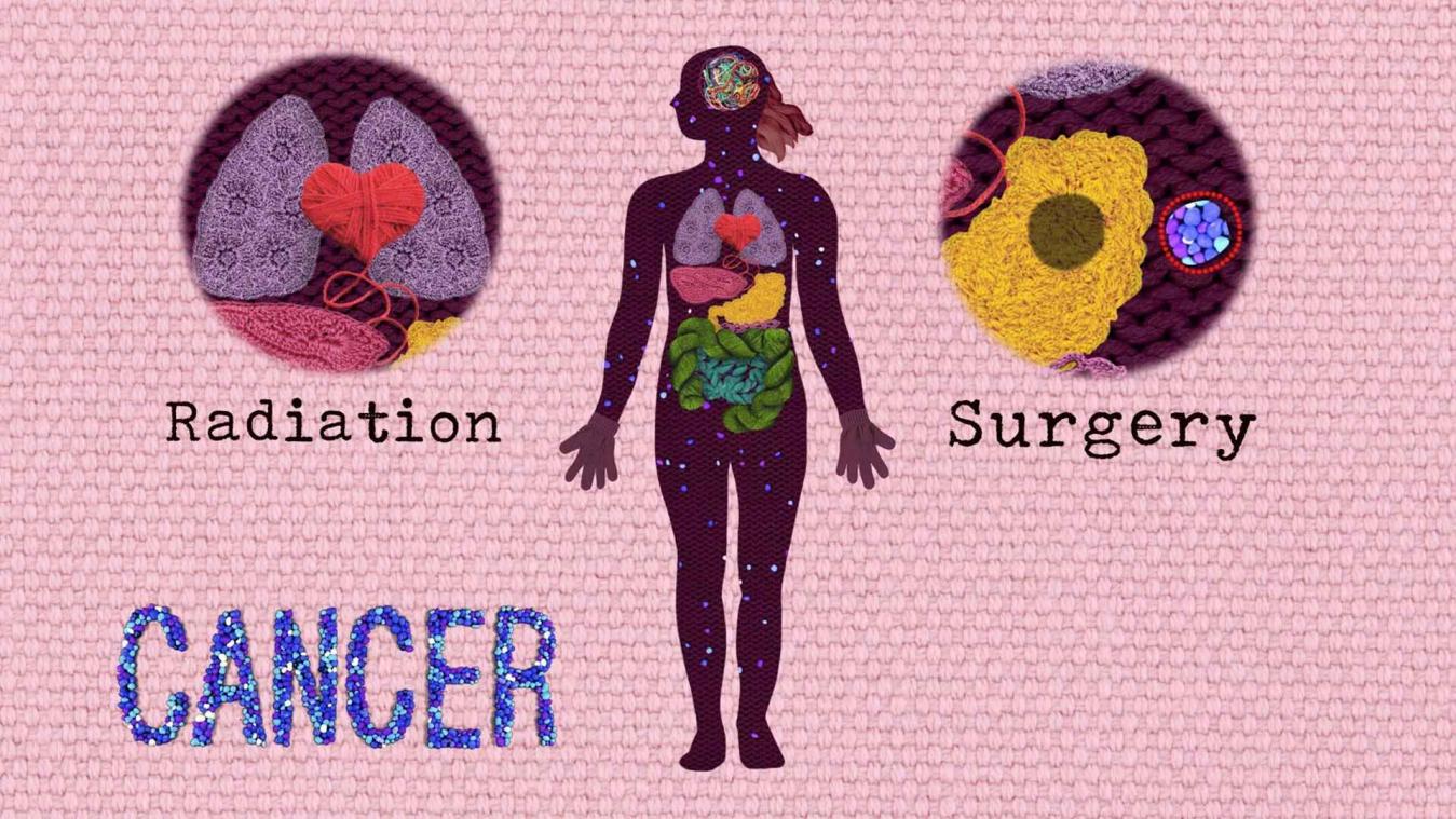 Tout ce que vous avez toujours voulu savoir sur le cancer - Metrotime