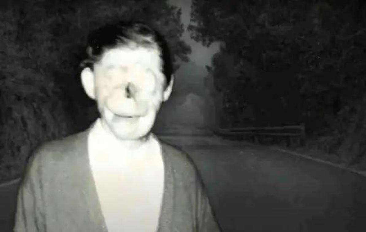 La véritable histoire de Charlie No-Face, l’homme qui a inspiré une ...