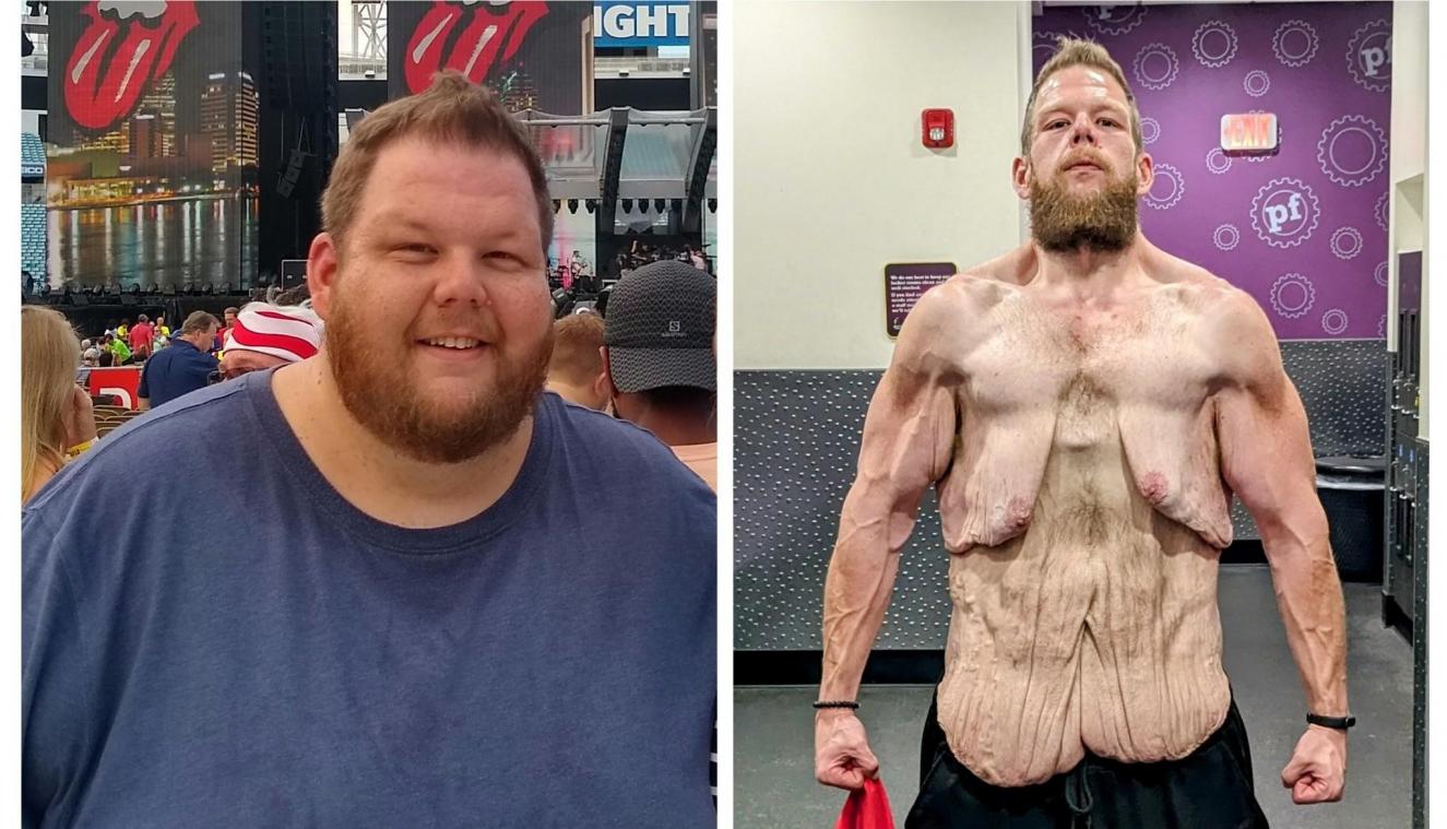 Voici à quoi ressemble son corps après avoir perdu plus de 150 kilos ...