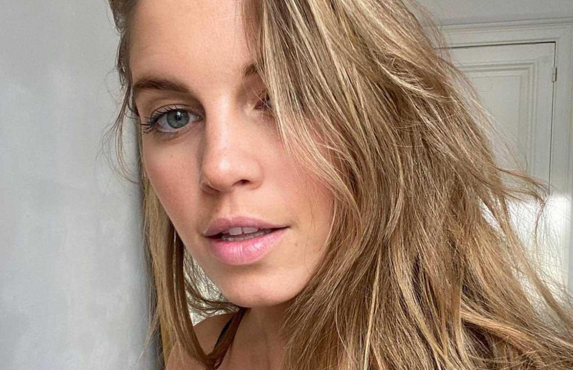 Bab Buelens poseert in bikini en toont litteken: «Iedereen zou dit ...