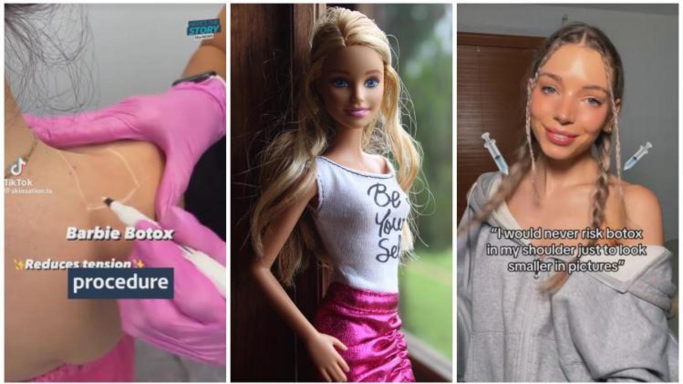 Barbie Botox: experts waarschuwen voor nieuwe beautytrend (video) - Metrotime
